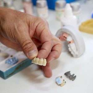 Dentures - The Denture & Implant Clinic